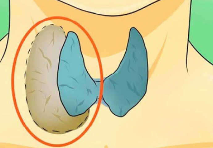 tiroidna - moezdravje.com